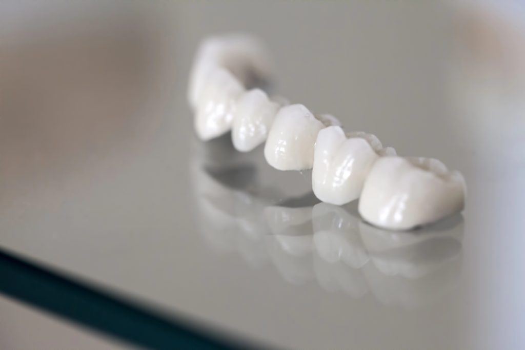 Natural-Looking Dental Crowns: Smile Without Compromise - Lund Dental ...